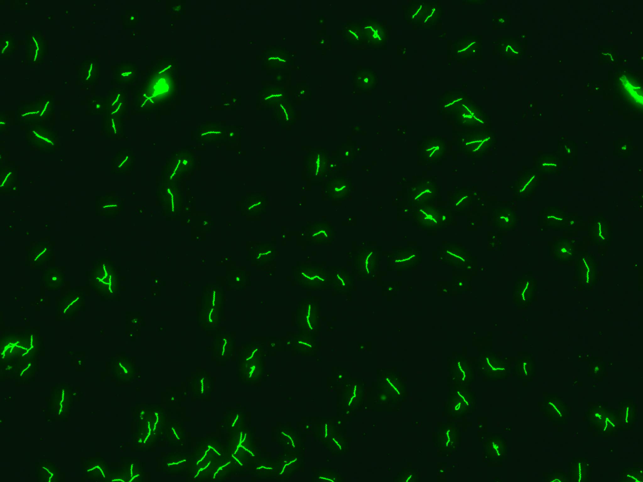 Erreger - Syphilis-Konsiliarlabor
